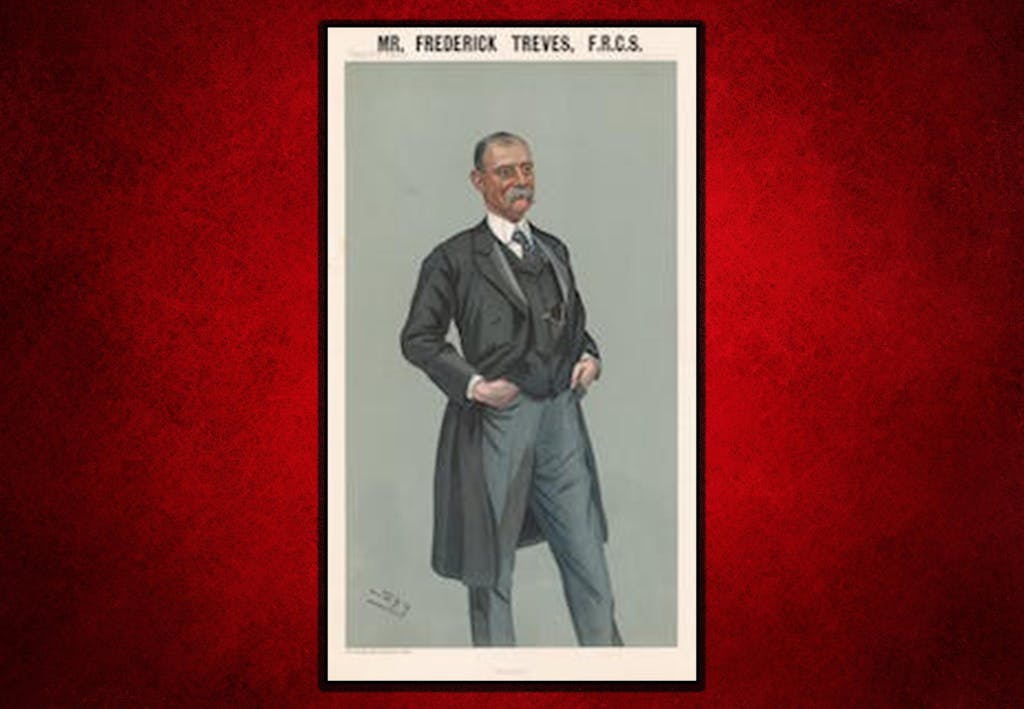 Elefantmannen fascinerte og forferdet alle | illvit.no