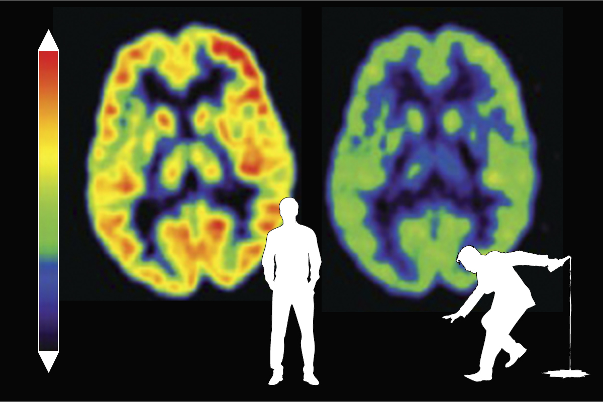 Alcohol: why alcohol makes us drunk | scienceillustrated.com