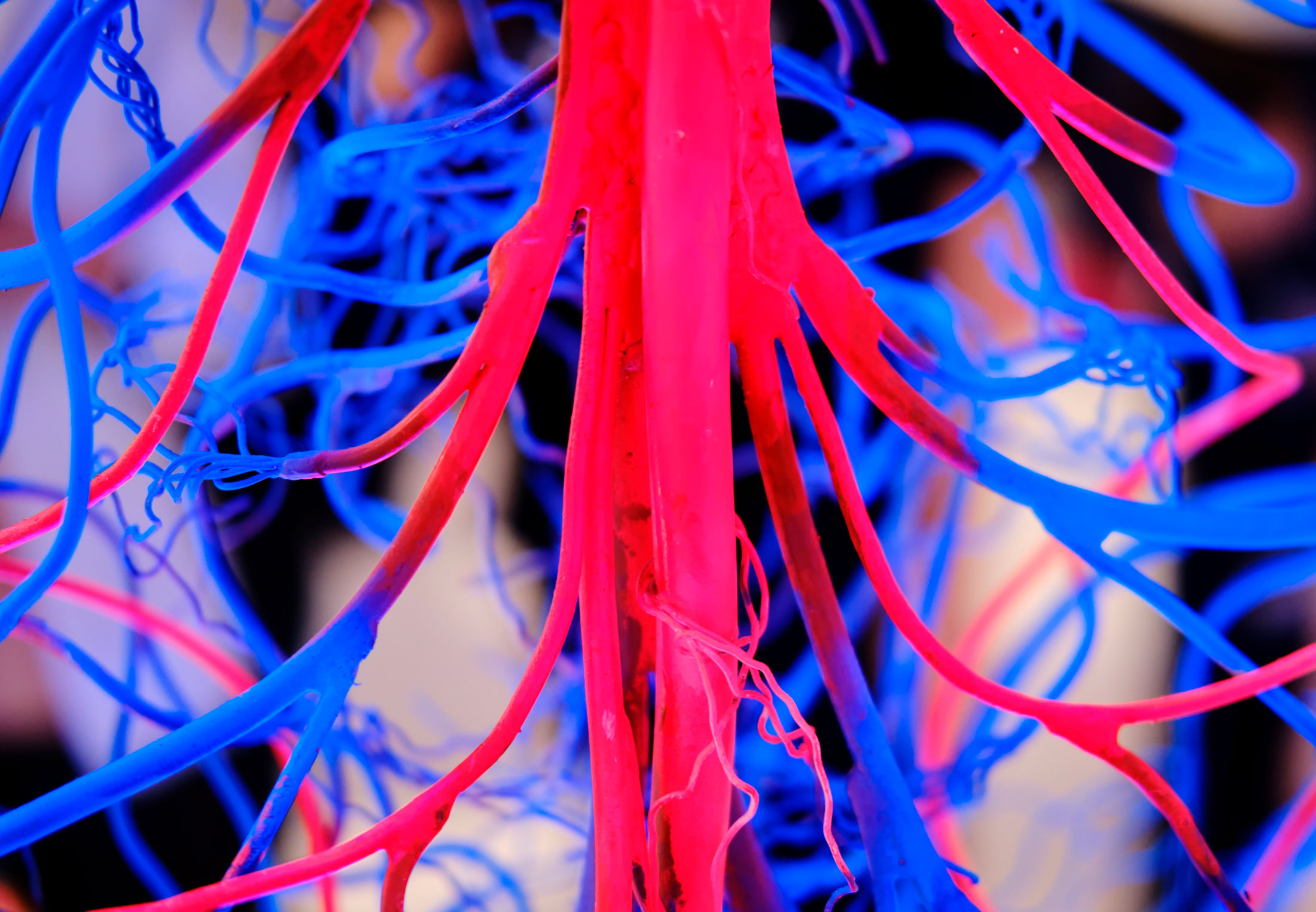 Broken heart syndrome kan koste flere menneskeliv end forventet | illvid.dk