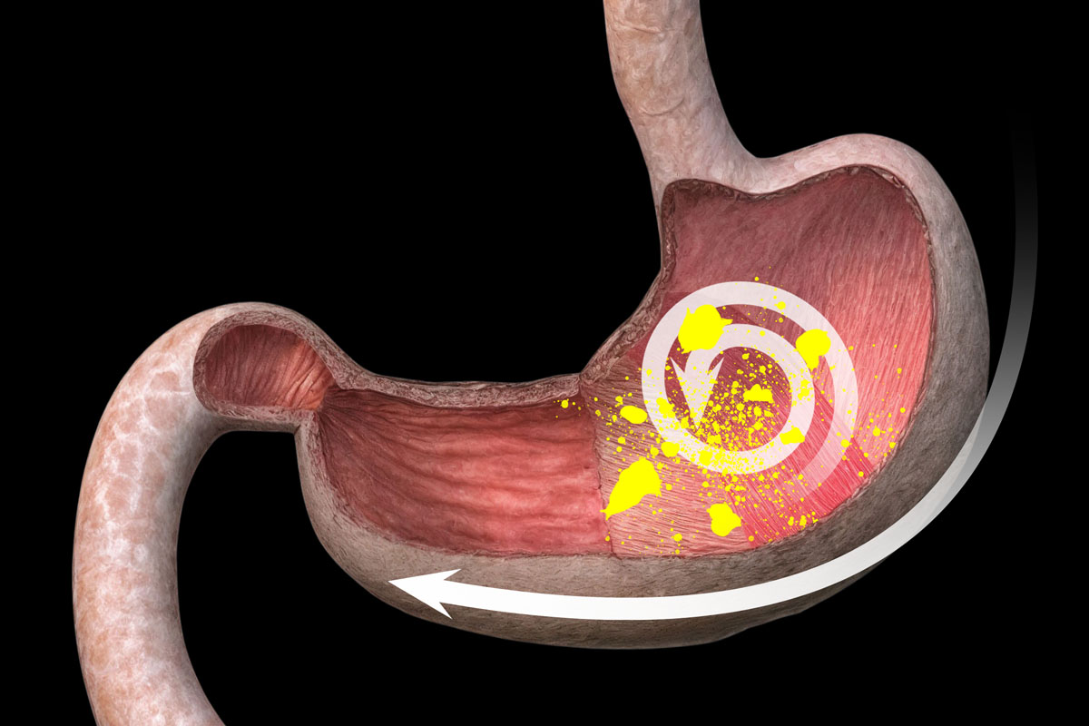 Hva skjer i magen når vi spiser mye mat? | illvit.no