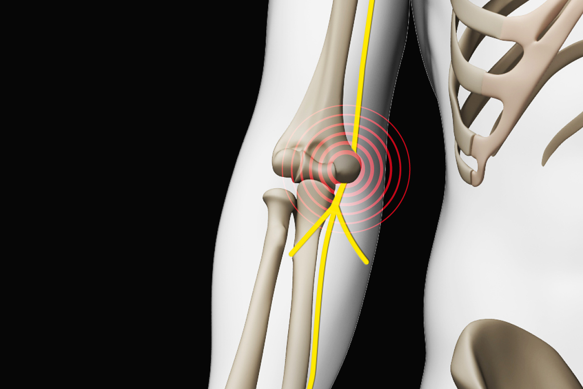 Derfor gør albuestød så ekstremt ondt | illvid.dk