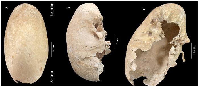 A routine excavation took an unexpected turn: an extremely rare ...