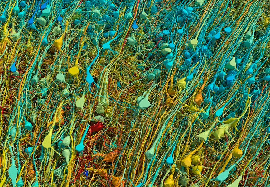 Brain tissue sample shows spectacular details | scienceillustrated.com