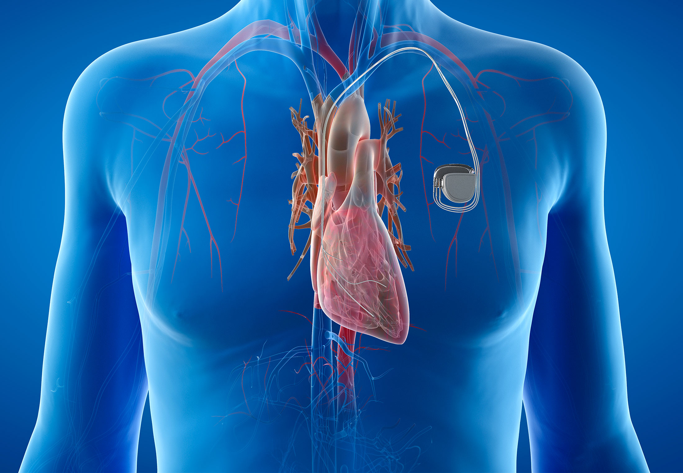 Researchers are developing a pacemaker that does not require a battery ...