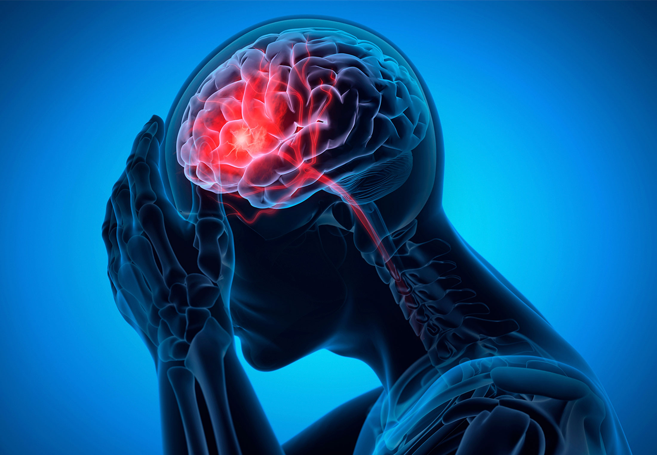 Hjerneslag: Bruk av tanntråd kan redusere risikoen for blodpropp i ...