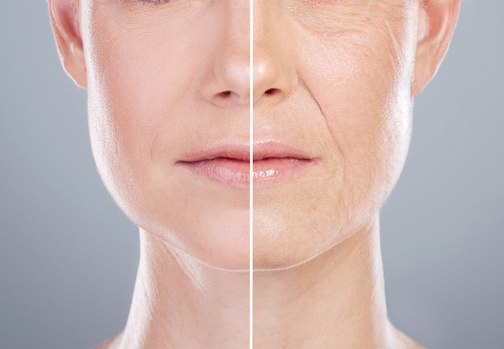 Sundhed - Hvad er sundhed? | illvid.dk