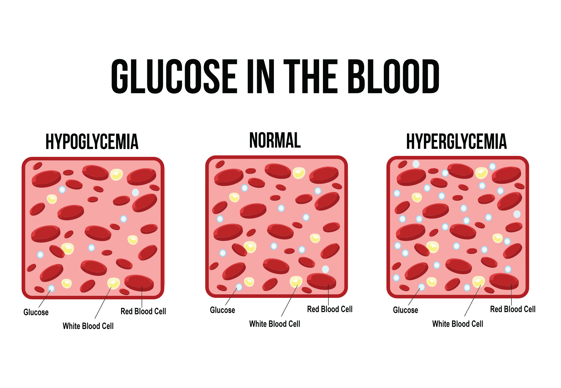 Wat is glucose en hoe meet je bloedglucose? | wibnet.nl
