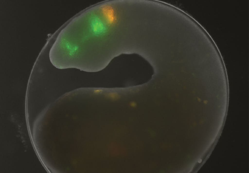 Study: humans bear a surprising resemblance to ancient sea creature ...