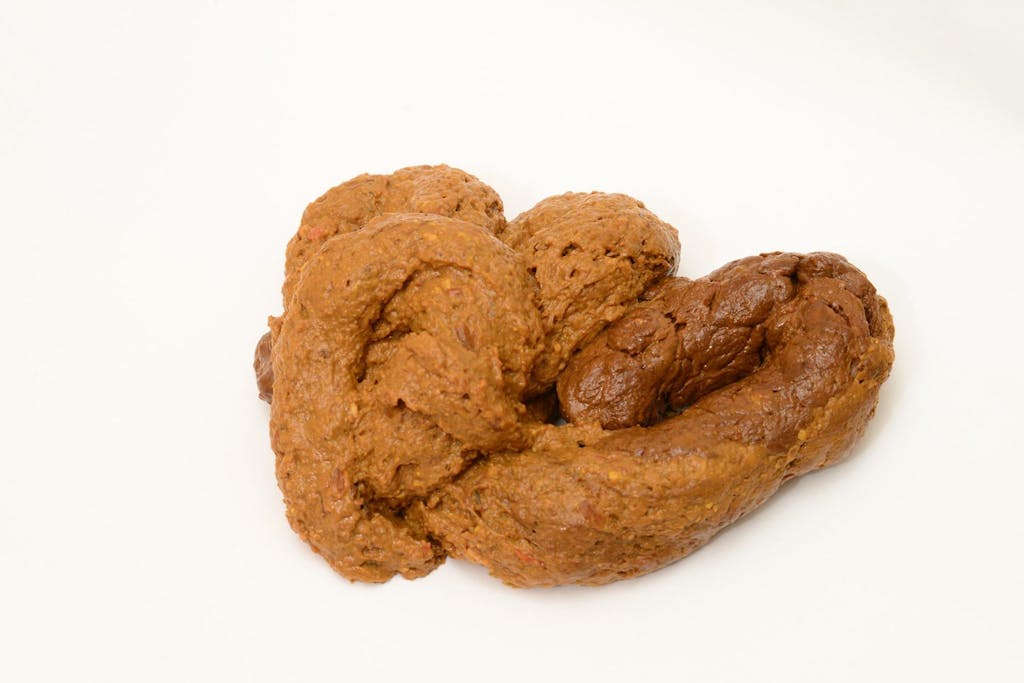 Ulosteen väri – tästä musta tai vihreä uloste kertoo | tieku.fi