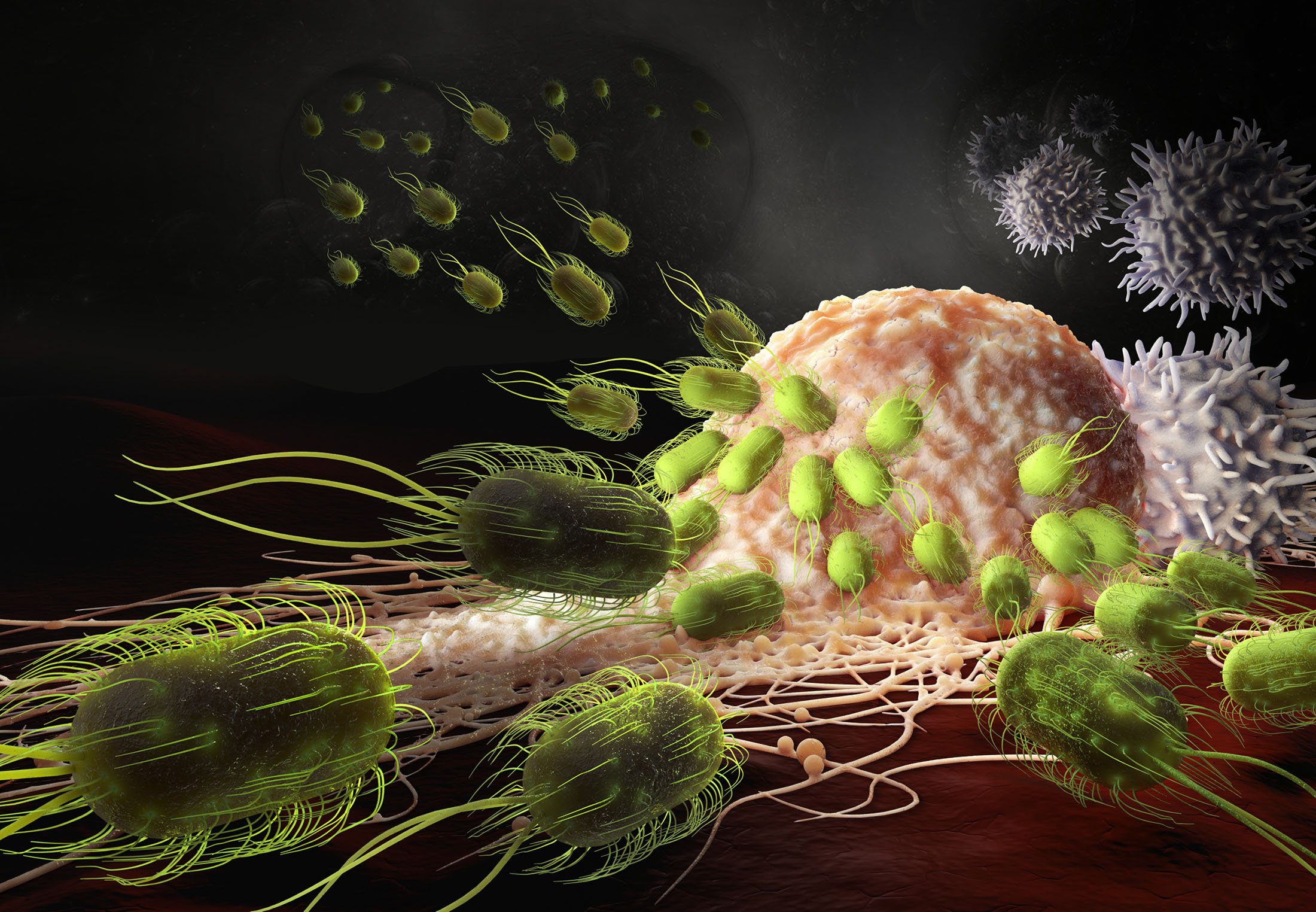 Lääkärien uusi tehoase: Bakteerit nujertavat syövän | tieku.fi