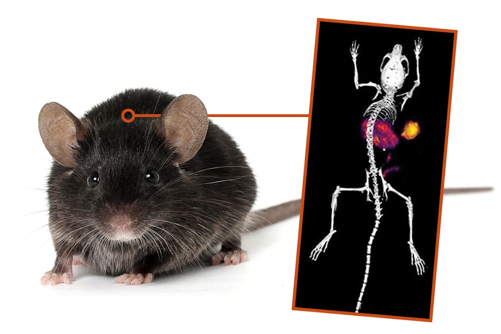 Lääkärien uusi tehoase: Bakteerit nujertavat syövän | tieku.fi