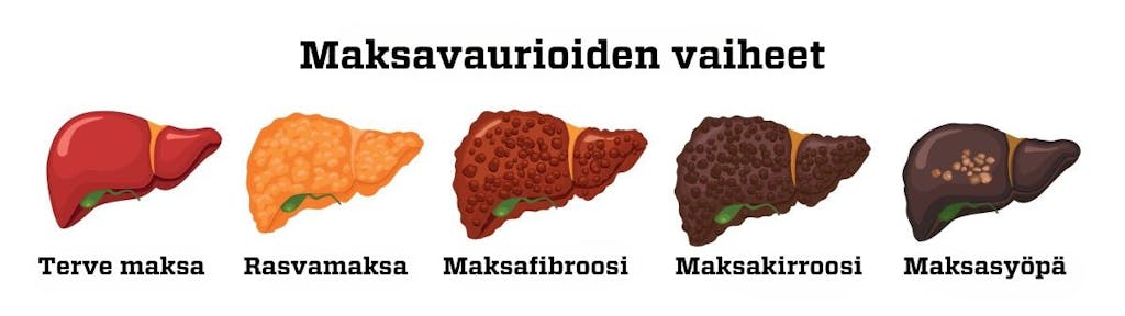 Maksa – näin se toimii | tieku.fi