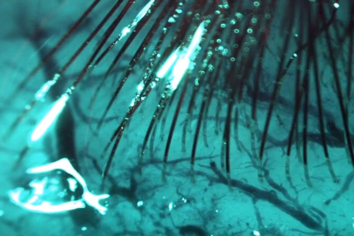 Neuralink: 6 things you need to know about the implant that connects ...