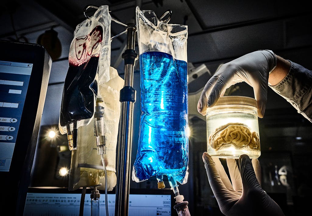 Onderzoekers wekken organen tot leven na de dood | wibnet.nl