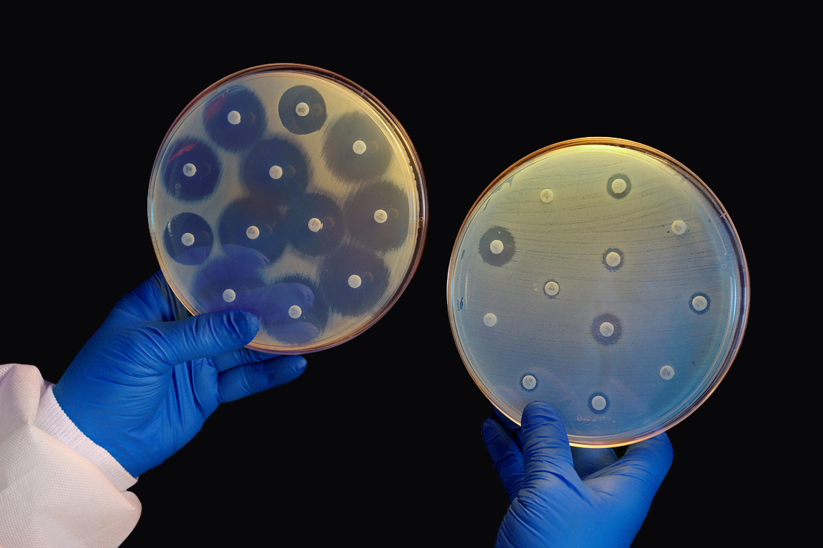 Multiresistente bakterier: Her er forskernes løsning | illvit.no