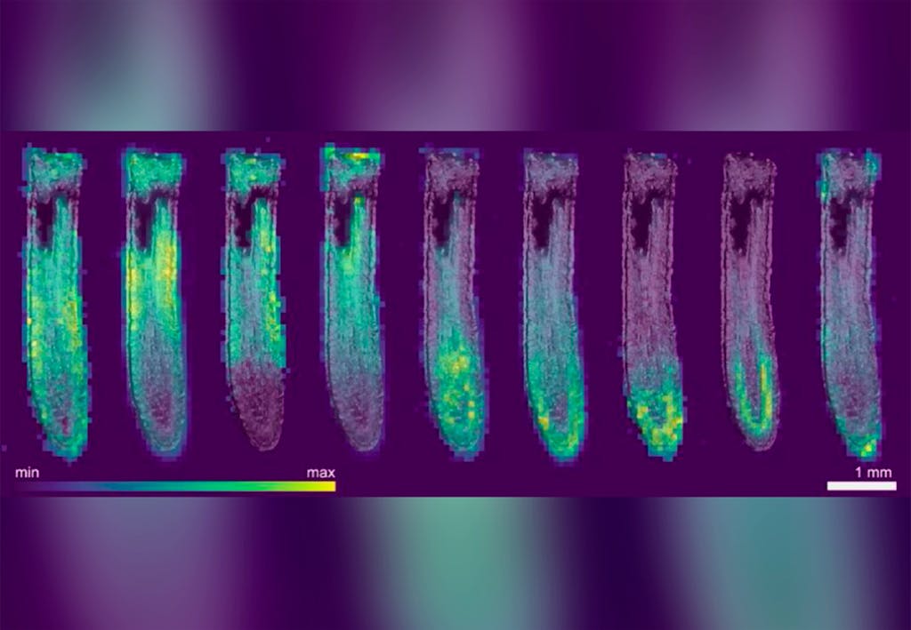 Växters rotsystem har kartlagts med cancerskanner | illvet.se