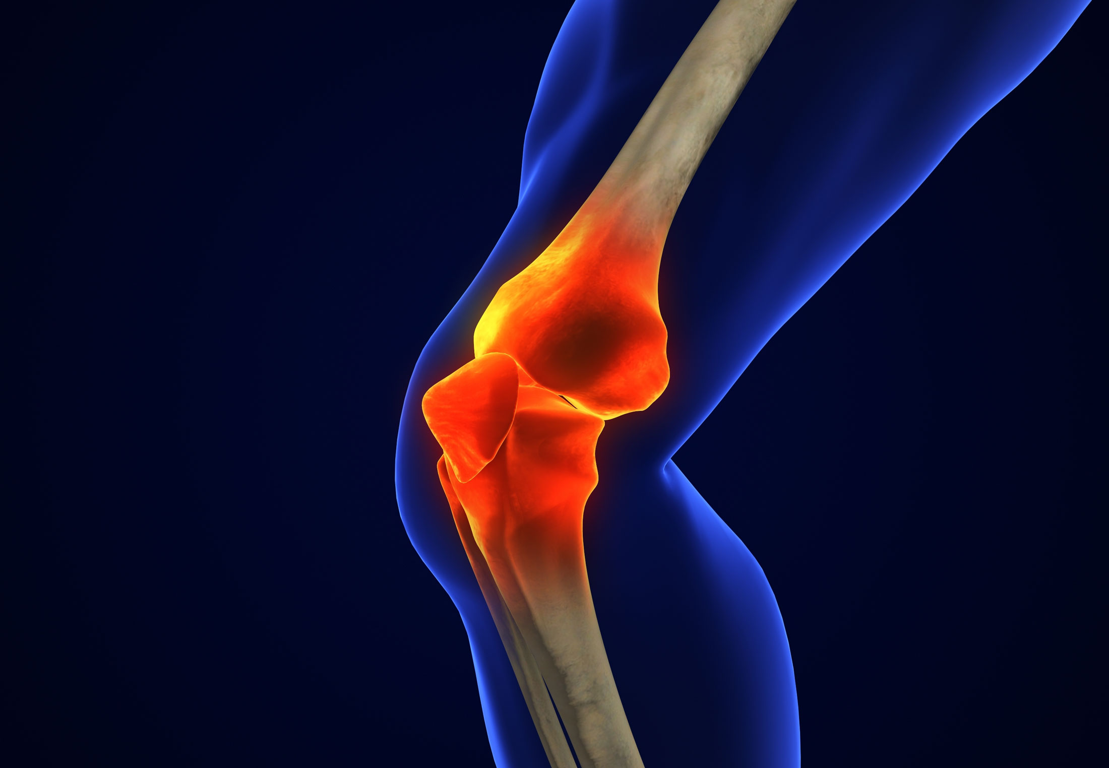 Behandlingen av artros revolutioneras med laserteknik | illvet.se