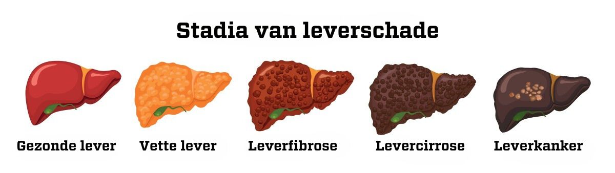 De lever – Zo werkt hij | wibnet.nl