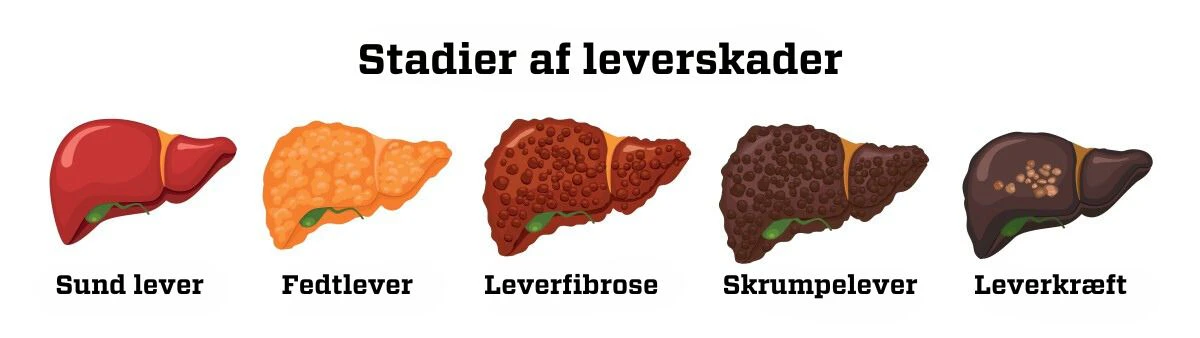 Leveren - sådan fungerer den | illvid.dk