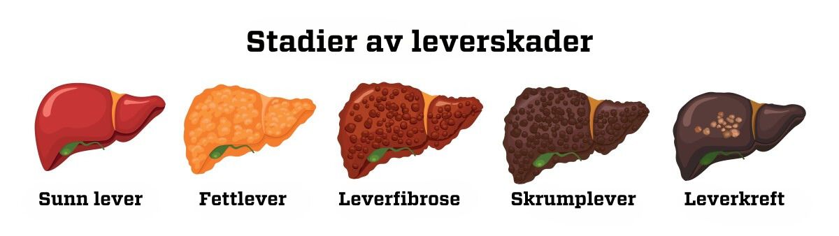 Leveren – slik virker den | illvit.no