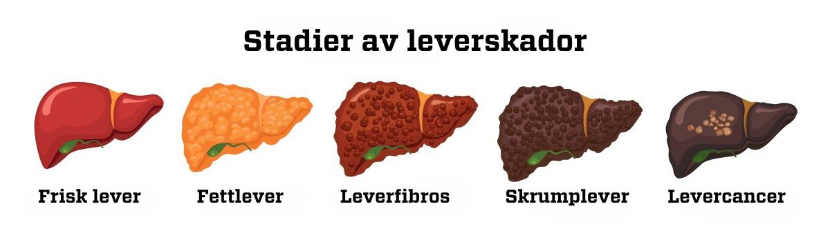 Levern – så funkar den | illvet.se