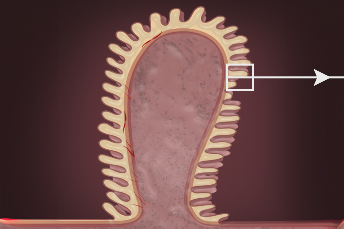 One thing is often blamed for giving us stomach problems. The ...