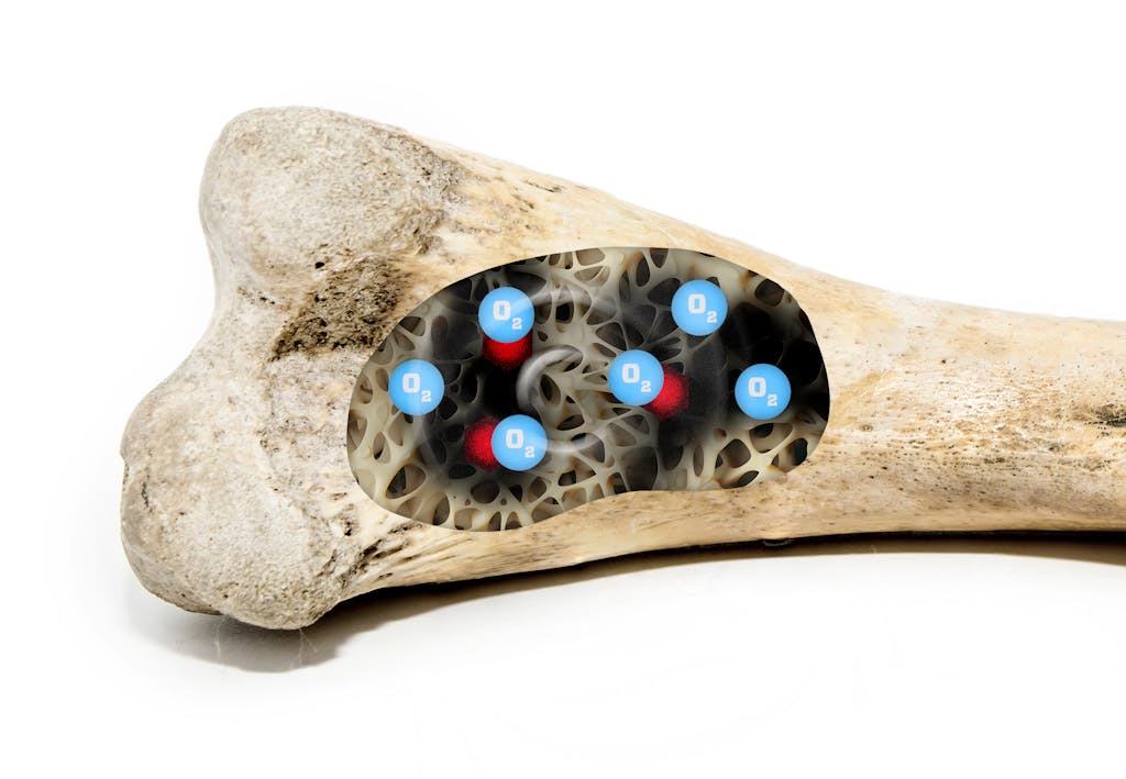 Kan man have sorte knogler? | illvid.dk